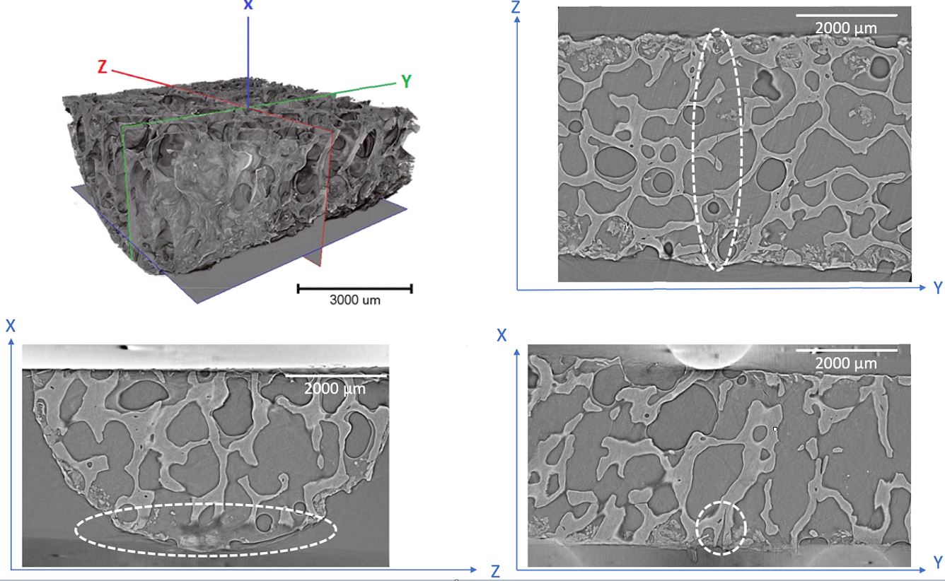 A method for fracture toughness measurement in trabecular bone using ...
